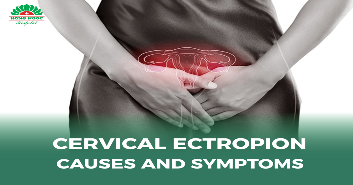 Treatment of cervical ectropion – Causes and symptoms of cervical ectropion