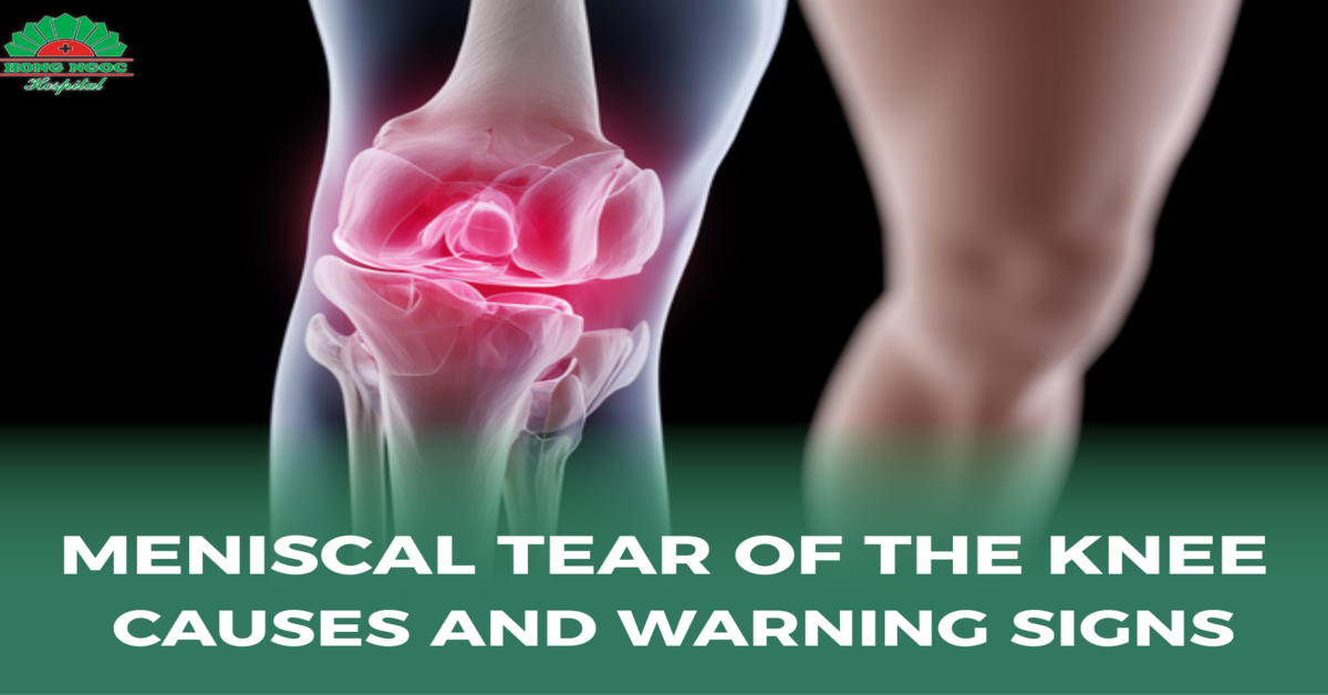 Meniscal tear of the knee: Causes and warning signs