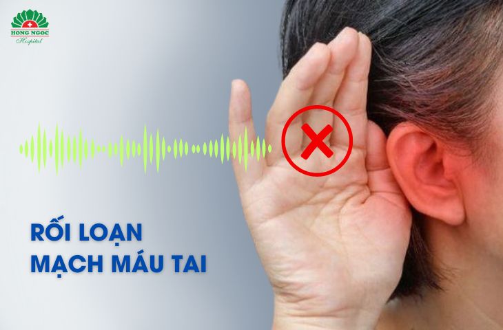Tại sao rối loạn mạch máu tai có thể gây điếc hoàn toàn?